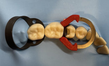 50 micron or 35 micron? A video introduction to TOR VM Matrix Bands ...